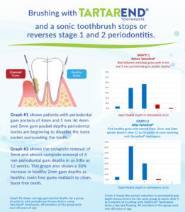 Periodontal Disease | TartarEnd Toothpaste