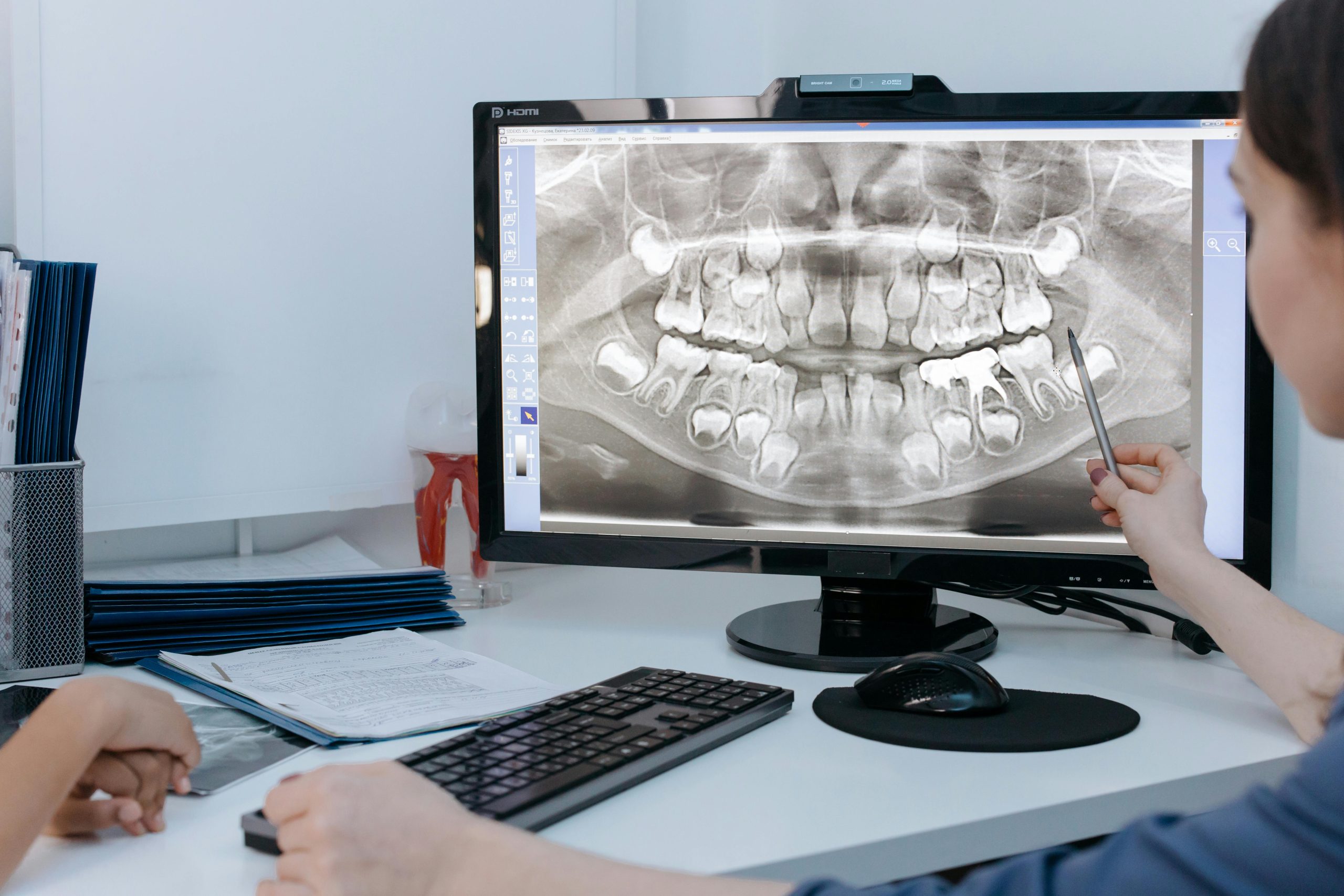 Remove Tartar & Plaque Above & Below The Gum Line | TartarEnd®