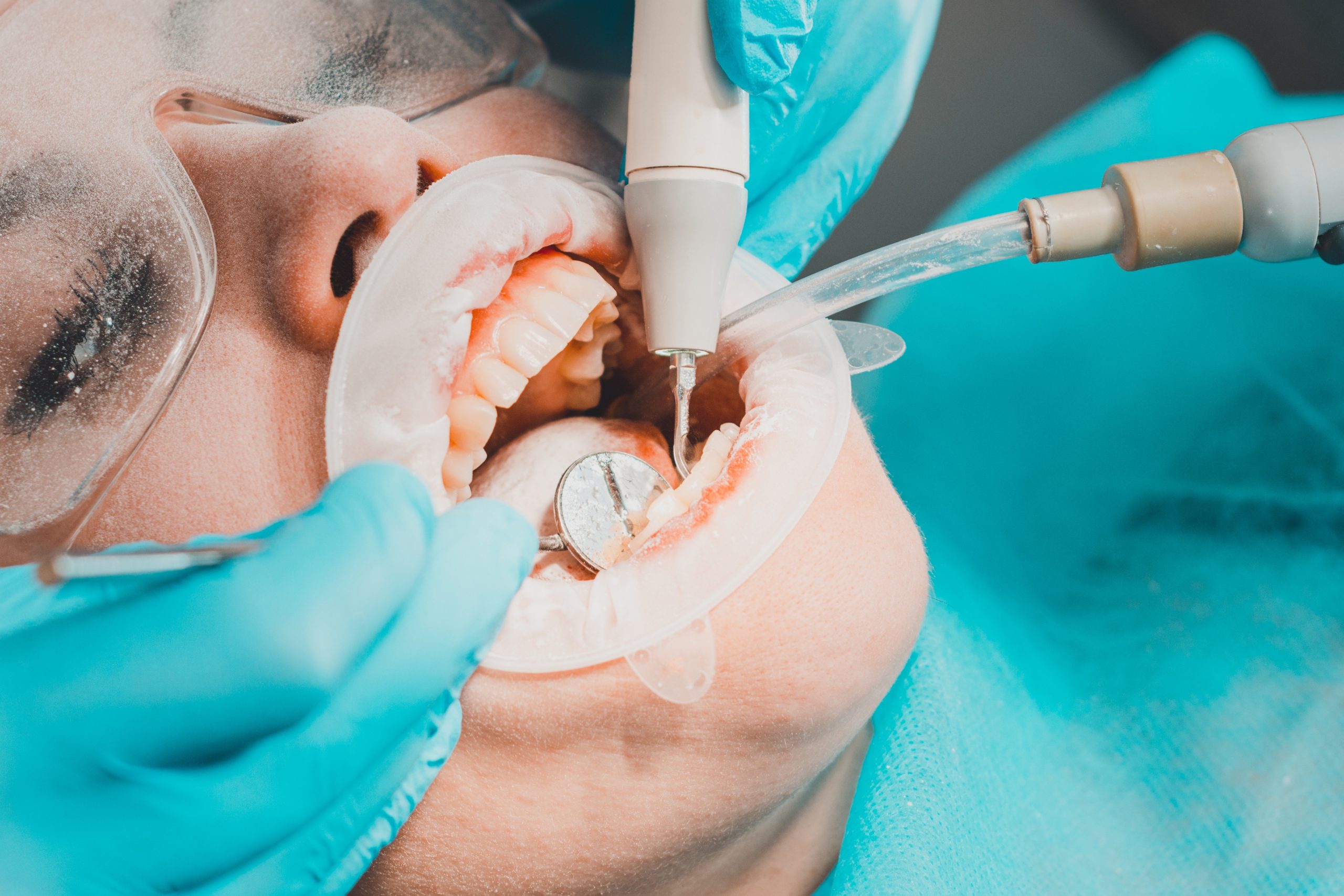 Why Don’t Many Dentists Recommend TartarEnd® toothpaste …….. Yet ...